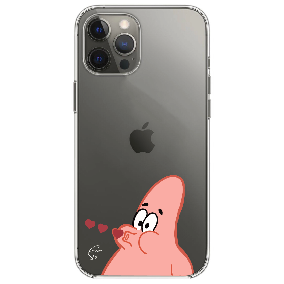 قاب Patrick Couple Set No.1 – CS istanbul